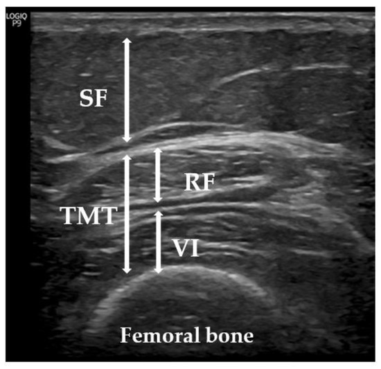 Role of Muscle Ultrasound for the Study of Frailty in Elderly Patients ...