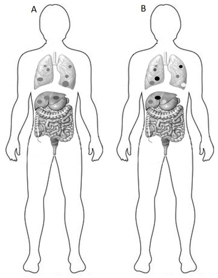 From Chaos to Opportunity: Decoding Cancer Heterogeneity for Enhanced ...