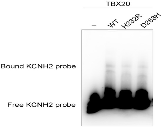 Discovery of TBX20 as a Novel Gene Underlying Atrial Fibrillation