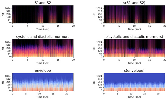 Biology | Free Full-Text | MCHeart: Multi-Channel-Based Heart Signal ...