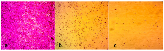 Biogenic Selenium Nanoparticles Anticancer Antimicrobial Insecticidal Properties And Their