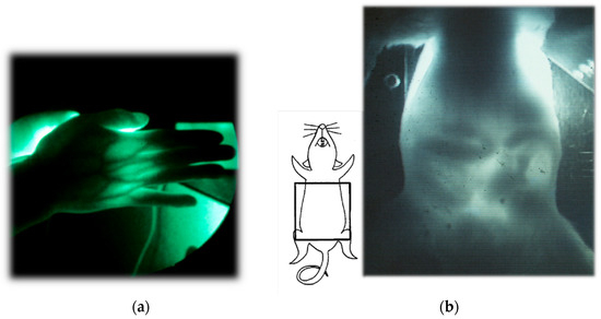 Near-Infrared Transillumination for Macroscopic Functional Imaging of ...