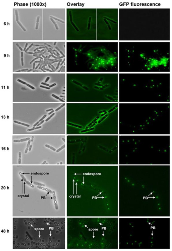 The Parasporal Body of Bacillus thuringiensis subsp. israelensis: A ...