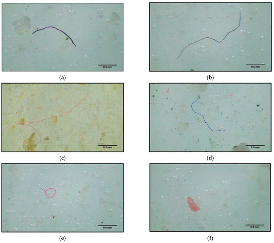 Microplastics in Different Tissues of a Commonly Consumed Fish ...