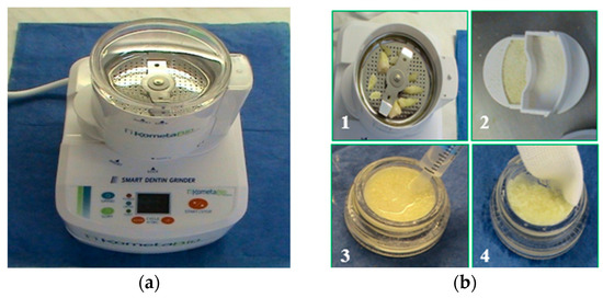 Stimulation of Osteogenic Activity of Autologous Teeth Hard Tissues as ...