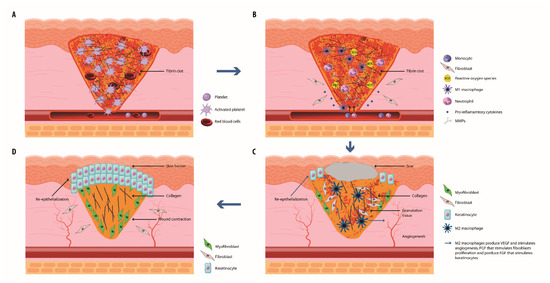Bacterial Biofilm in Chronic Wounds and Possible Therapeutic Approaches