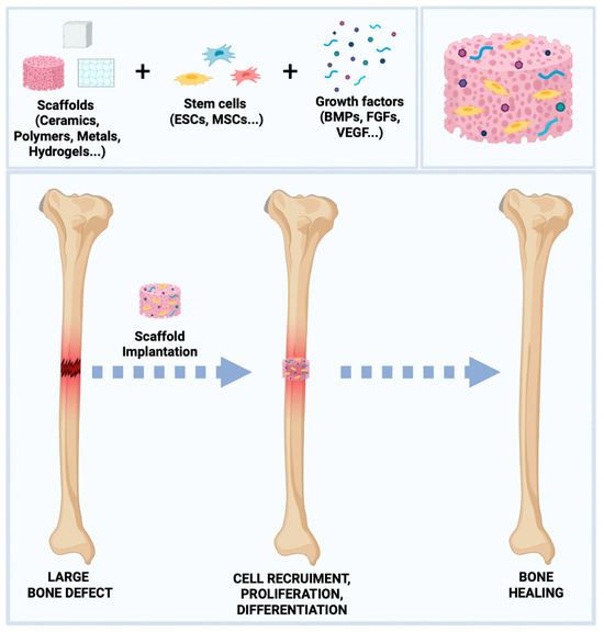 Bone Tissue Engineering and Nanotechnology: A Promising Combination for ...