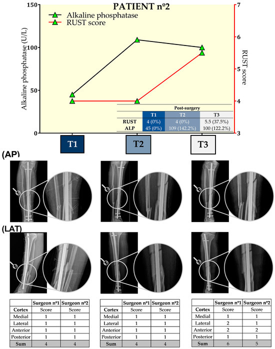 Comparison of Radiographic Outcomes Assessed via the Radiographic Union ...
