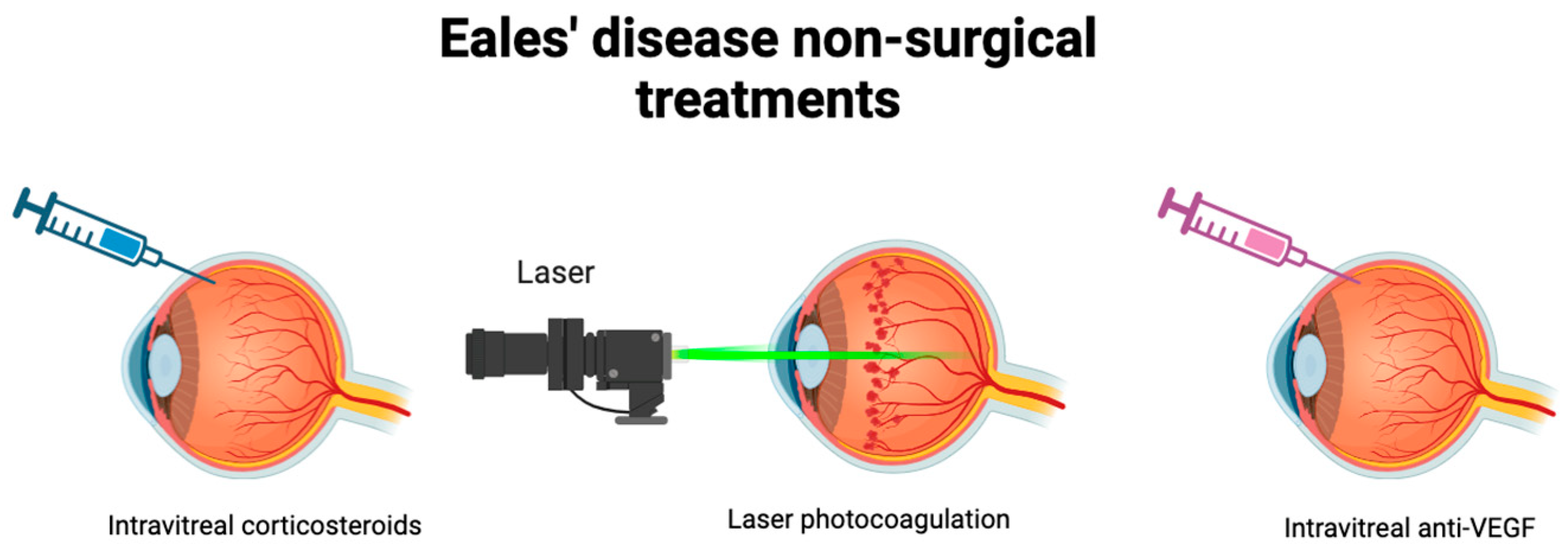 A Review of Eales’ Disease and Mycobacterium tuberculosis