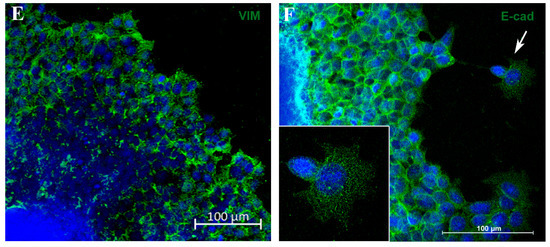 Spheroid Model of Mammary Tumor Cells: Epithelial–Mesenchymal ...