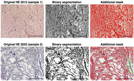Assessment of Extracellular Matrix Fibrous Elements in Male Dermal ...