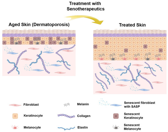 Mechanisms of Senescence and Anti-Senescence Strategies in the Skin