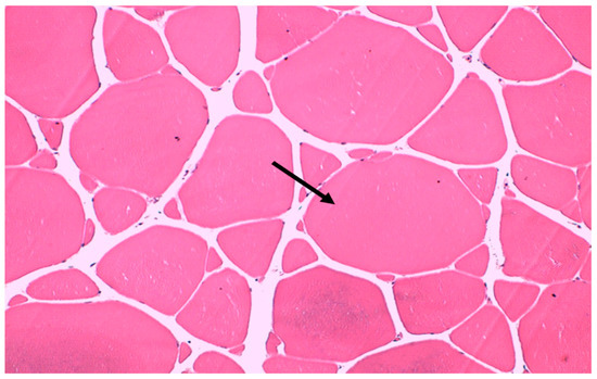Effect of Dietary Digestible Protein Levels on Muscle Growth and ...