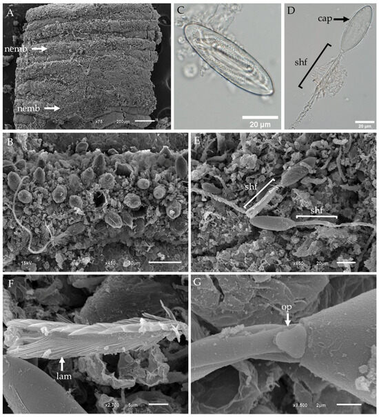 Nematocyst Types and Characteristics in the Tentacles of Gershwinia ...