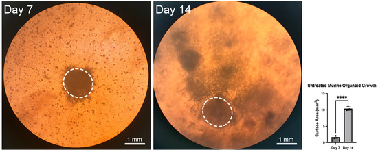 Precision Medicine: IL-1RA and Pancreatic Cancer Organoids