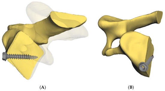 Biomechanics | An Open Access Journal from MDPI