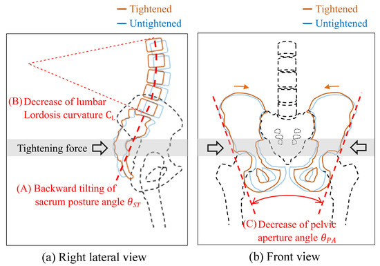 Modeling Joint Stiffness Change by Pelvic Tightening Based on Pelvic ...