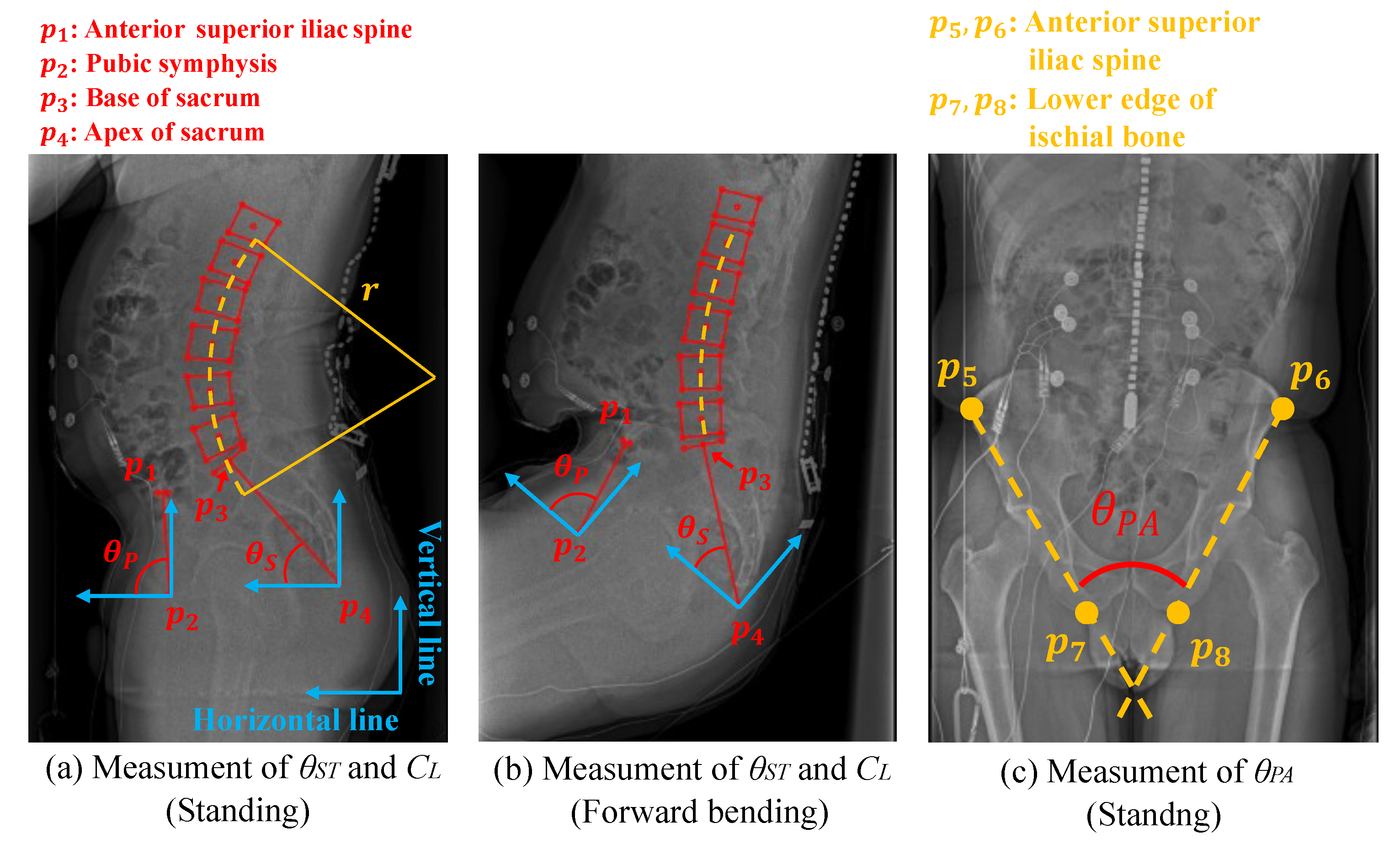 Modeling Joint Stiffness Change by Pelvic Tightening Based on Pelvic ...