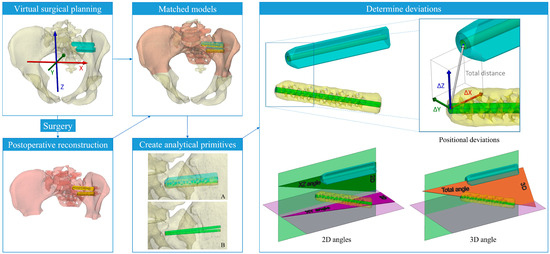 Patient-Specific 3D Virtual Surgical Planning Using Simulated ...