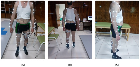 Biomechanics | Free Full-Text | The Impact of Different Self-Selected Walking Speeds on Muscle ...