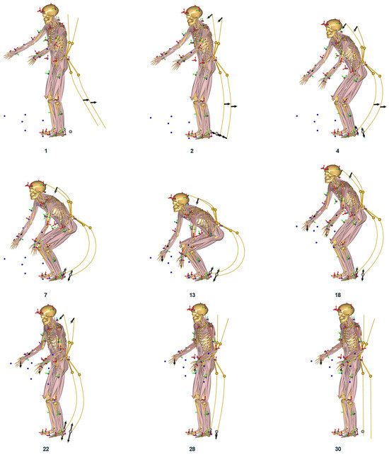Advancing Biomechanical Simulations: A Novel Pseudo-Rigid-Body Model ...