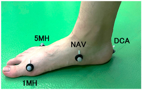 Classifications Based on Dynamic Navicular Drop during Gait and ...