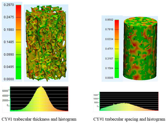 Characterization of Microarchitectures, Stiffness and Strength of Human ...