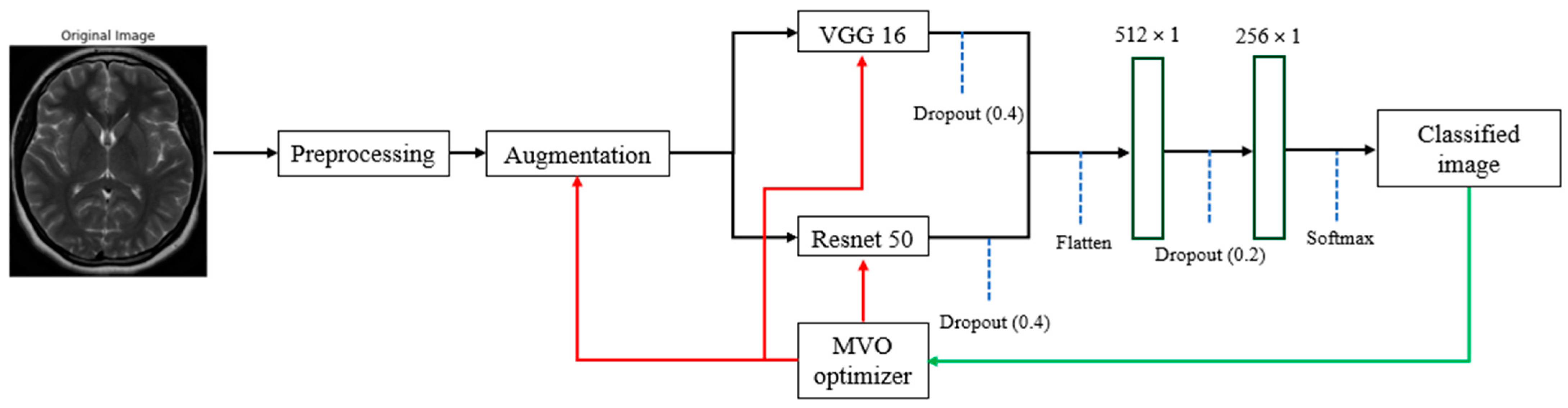 Advancing Brain MRI Image Classification: Integrating VGG16 and ResNet50 with a Multi-Verse ...