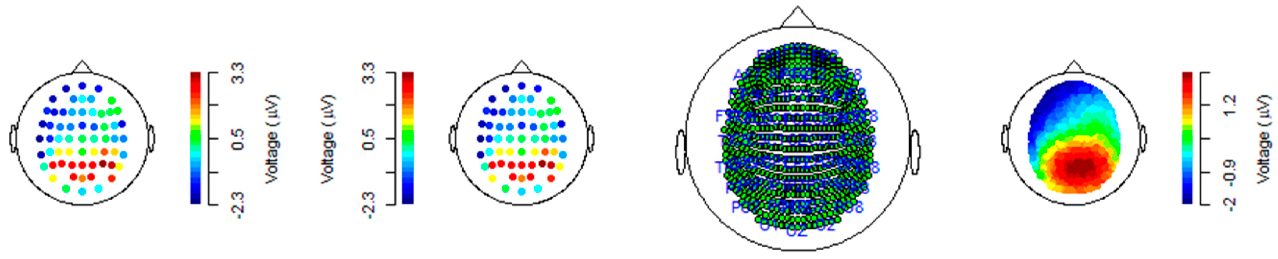 Review of Multimodal Data Acquisition Approaches for Brain–Computer ...