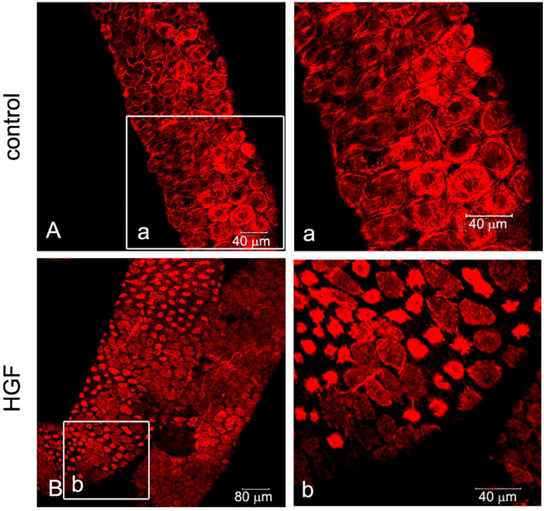 HGF Modulates Actin Cytoskeleton Remodeling and Contraction in ...
