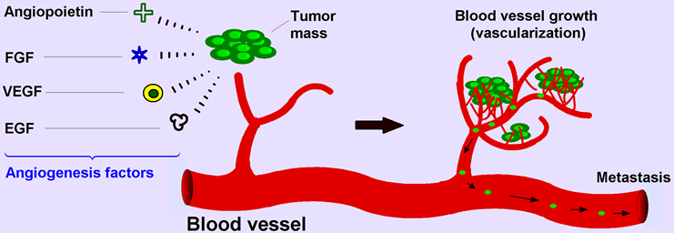 Biomedicines | Free Full-Text | The Role of Angiogenesis in Cancer ...