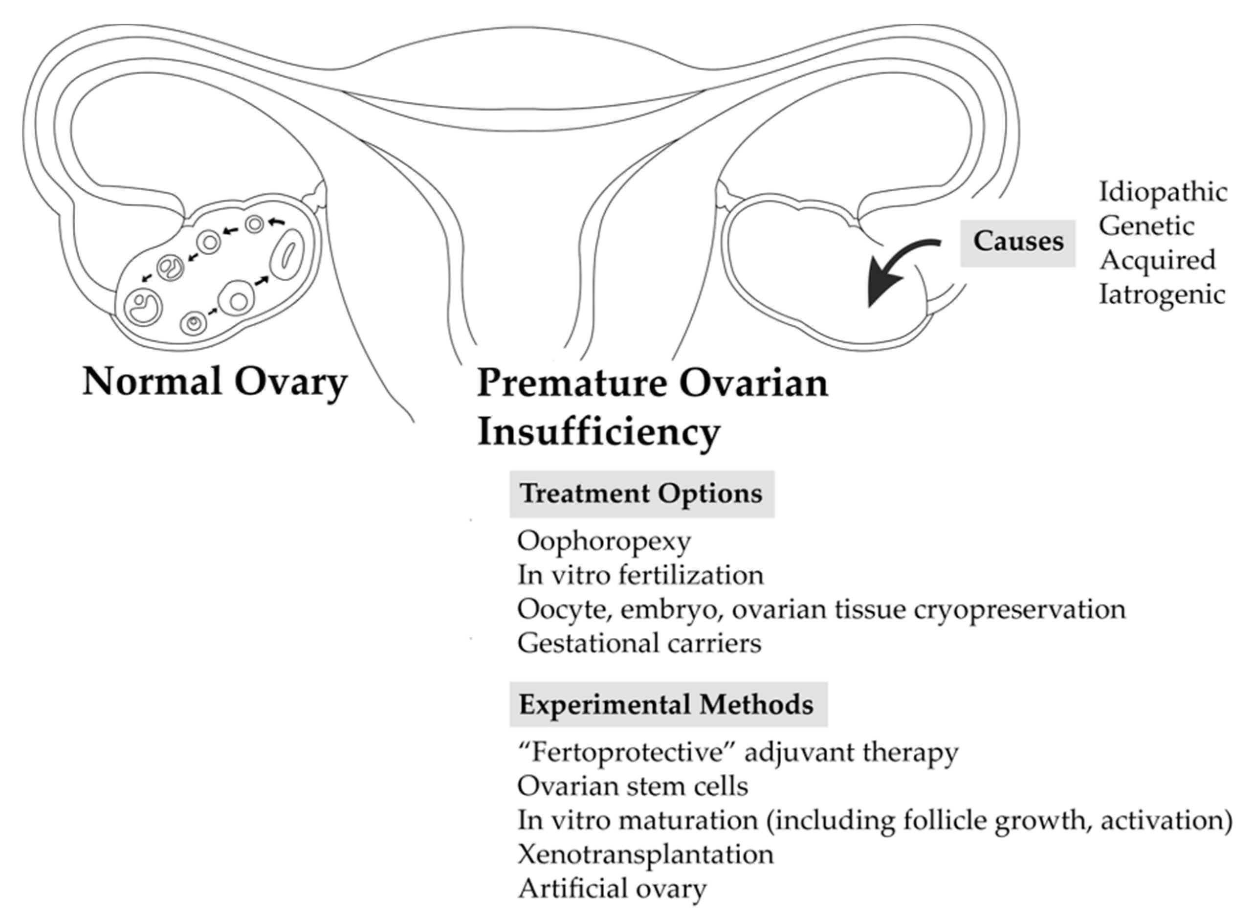 Biomedicines Free Full Text Premature Ovarian Insufficiency