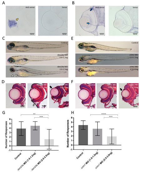 Biomedicines | Special Issue : Zebrafish Models for Development and Disease Biomedicines | Special Issue : Zebrafish Models for Development and Disease