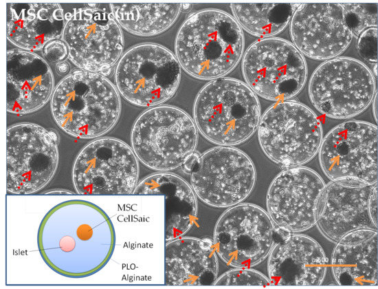 Biomedicines | Free Full-Text | Co-Microencapsulation of Islets and MSC ...