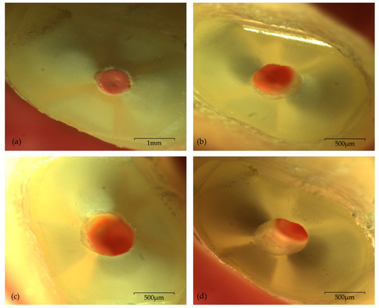 Evaluation of Root-End Preparation with Two Different Endodontic ...