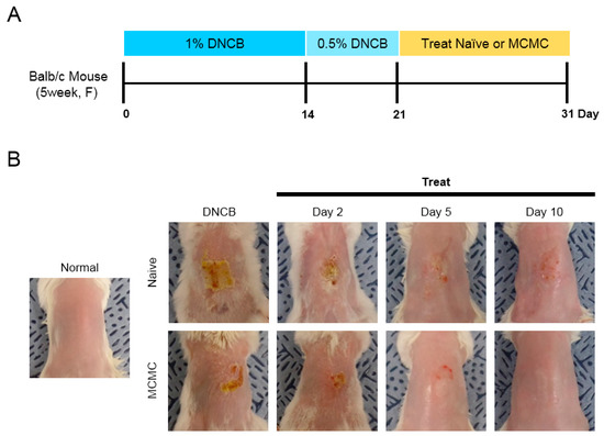 Anti-Inflammatory Effects of M-MSCs in DNCB-Induced Atopic Dermatitis Mice