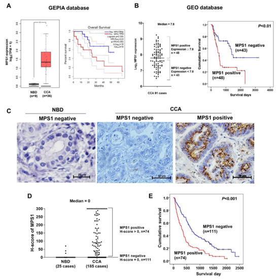 High Monopolar Spindle 1 Is Associated with Short Survival of ...