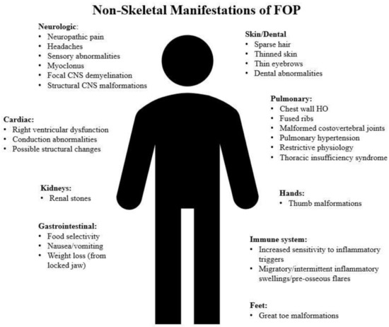 Cardiopulmonary and Neurologic Dysfunctions in Fibrodysplasia ...