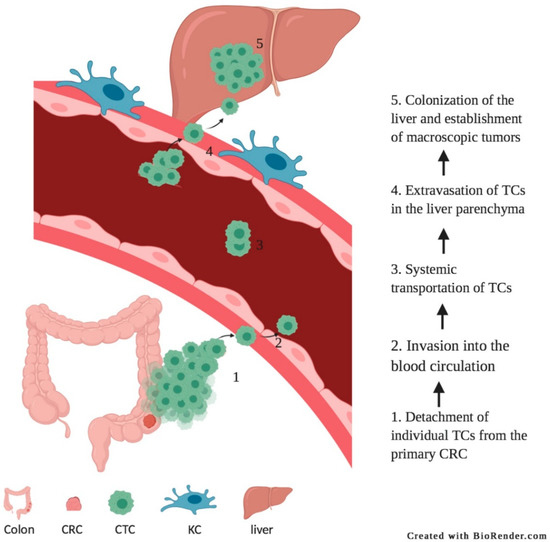 Biomedicines Free Full Text Surgery For Colorectal Cancer A