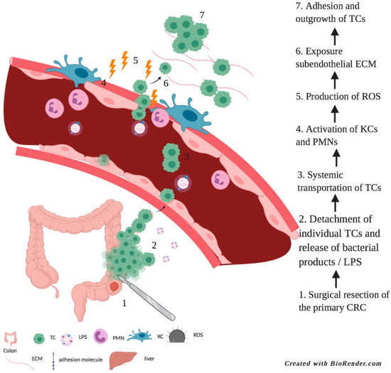 Surgery for Colorectal Cancer: A Trigger for Liver Metastases ...