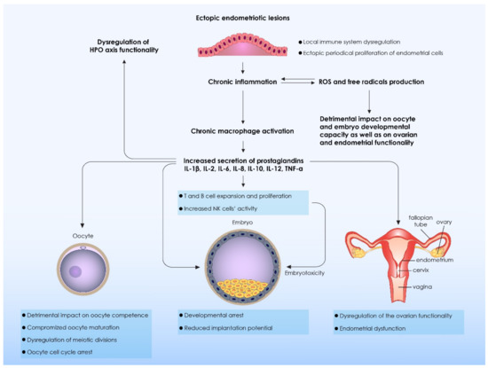 Getting to Know Endometriosis-Related Infertility Better: A Review on ...