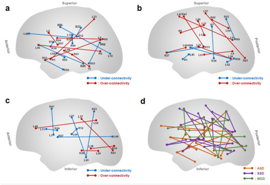 Psychiatric Neural Networks and Precision Therapeutics by Machine Learning