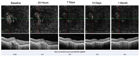 Biomedicines | Special Issue : WAMD: From Pathophysiology to ...
