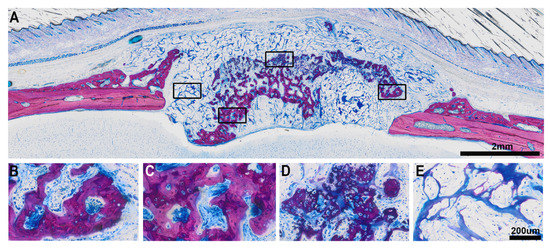 Osteoconductive Properties of a Volume-Stable Collagen Matrix in Rat ...