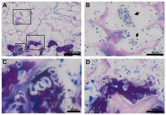 Osteoconductive Properties of a Volume-Stable Collagen Matrix in Rat ...