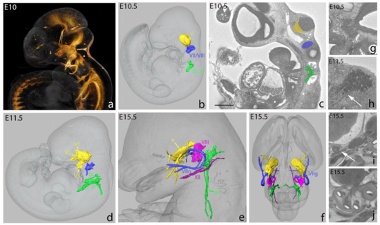 High Resolution Episcopic Microscopy for Qualitative and Quantitative ...