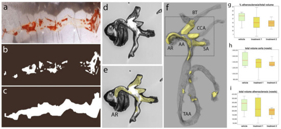 High Resolution Episcopic Microscopy for Qualitative and Quantitative ...