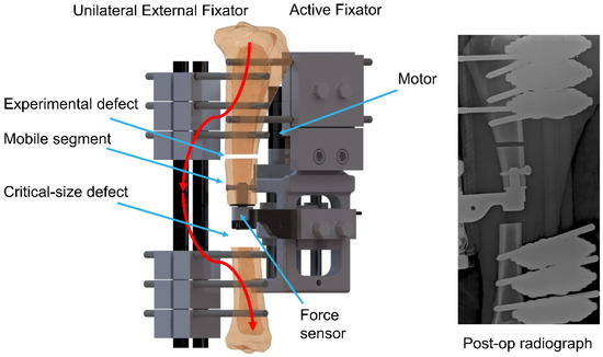 Biomedicines | Special Issue : New Ground-Breaking Strategy in Bone ...