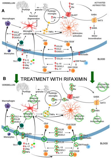 Rifaximin Prevents T-Lymphocytes and Macrophages Infiltration in ...