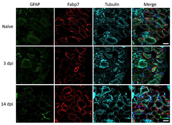 Discrepancy in the Usage of GFAP as a Marker of Satellite Glial Cell ...